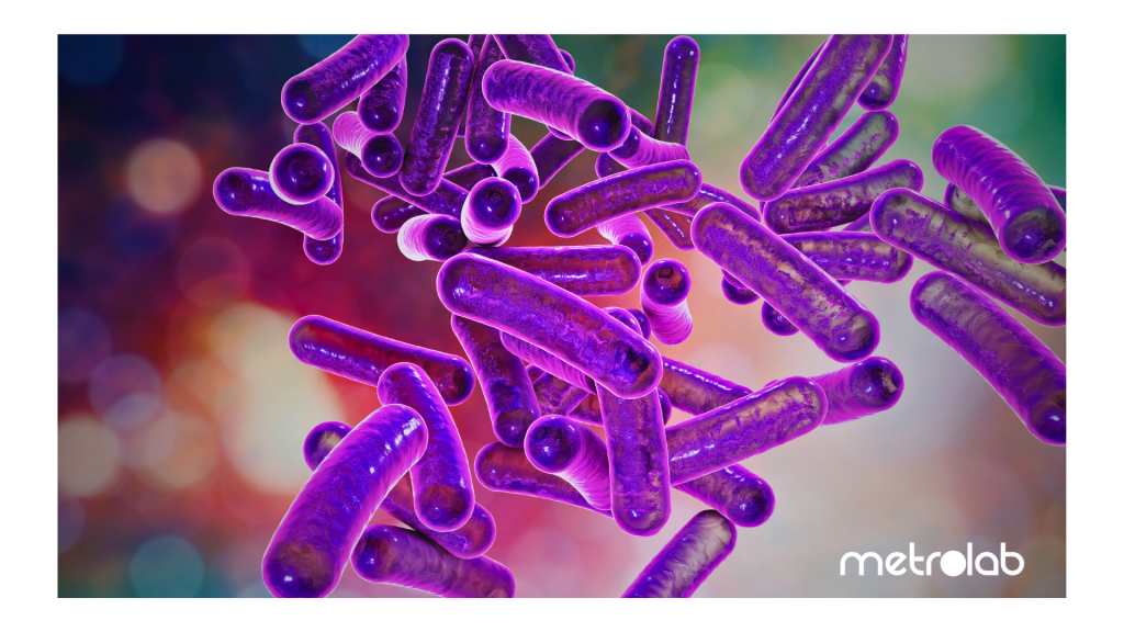 Redefining Rapid Microbial Detection with Celsis